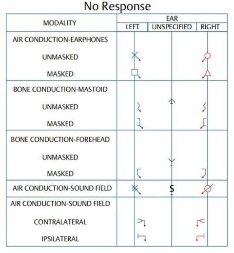 Pure Tone Audiogram: Symbols | Configuration | Interpretation