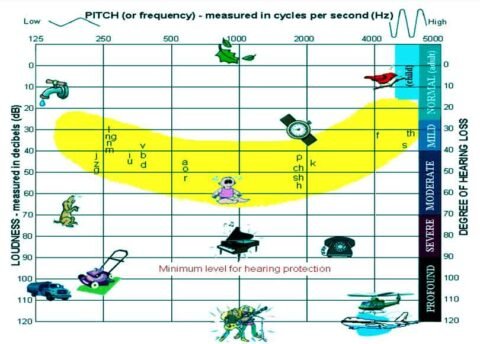 Pure Tone Audiogram: Symbols | Configuration | Interpretation