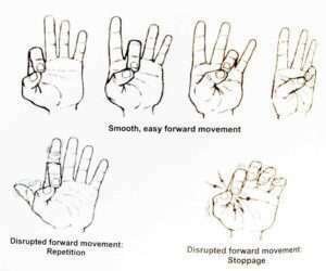 Different Techniques and Strategies used in Management of Stuttering